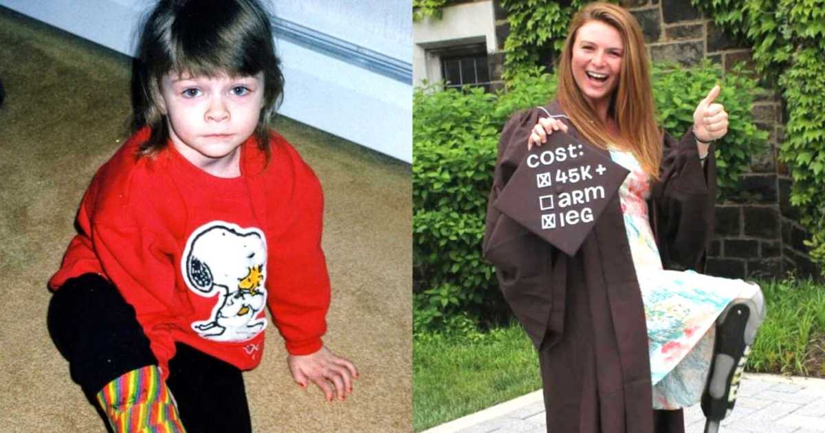 ‘Tomorrow, your foot won’t be there.’ It looked like it went through a ...