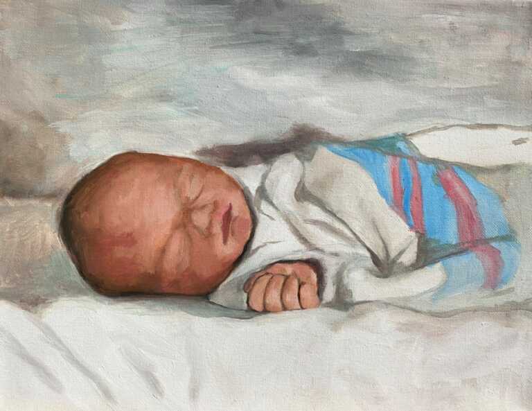 This Woman Normalizing Unique Birthmarks Through Stunning Portraits Of ...