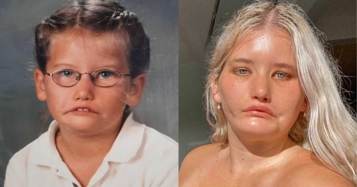 ‘Not being able to smile is the greatest gift I could’ve been given ...